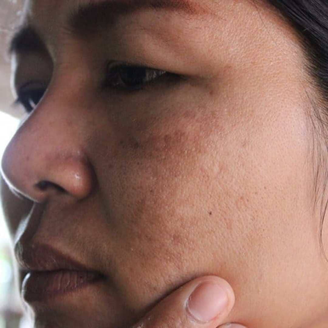 Skin Brighteners & Dull Skin Treatments | Orion Beauty Sri Lanka
